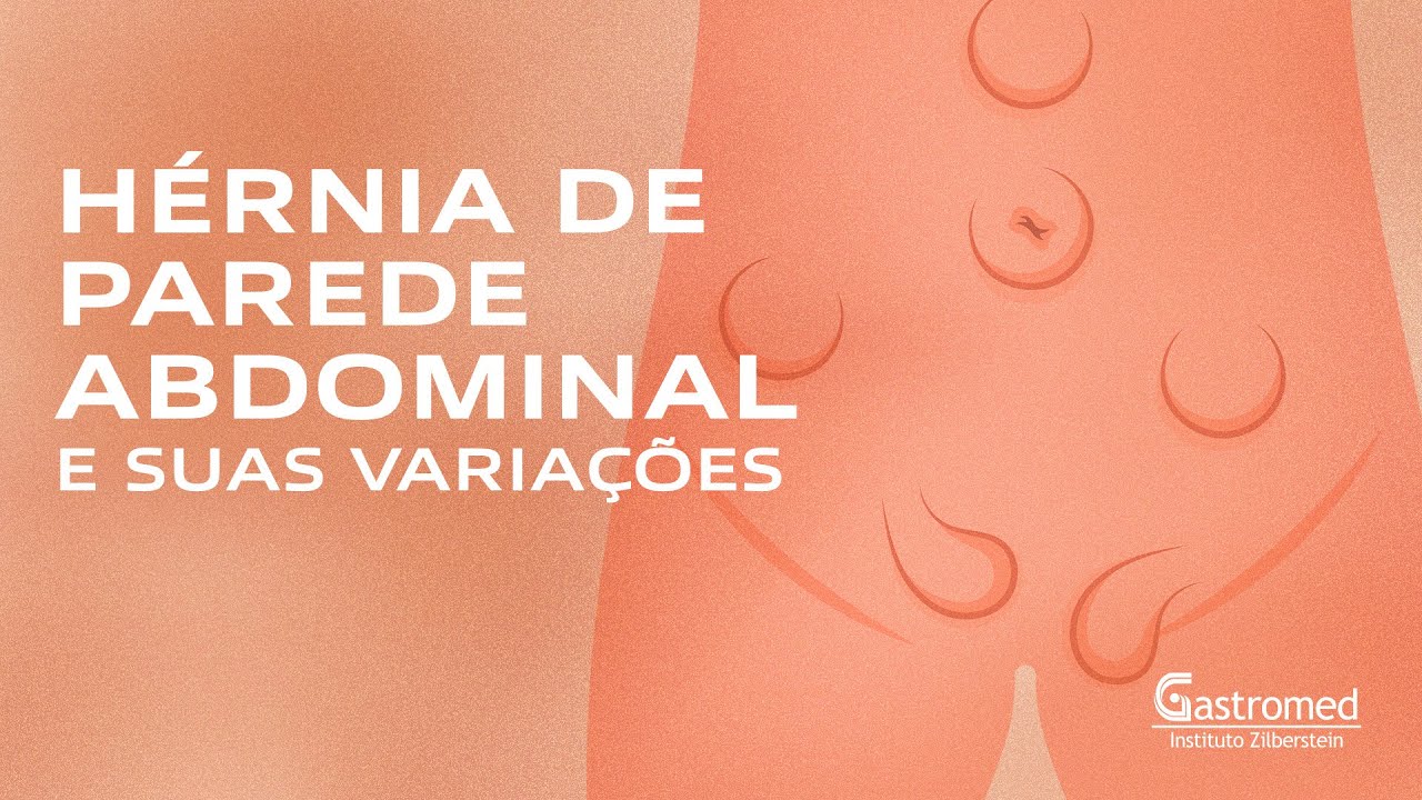 Hérnia de Parede Abdominal: 6 Tipos, Sintomas e Tratamento Cirúrgico ...